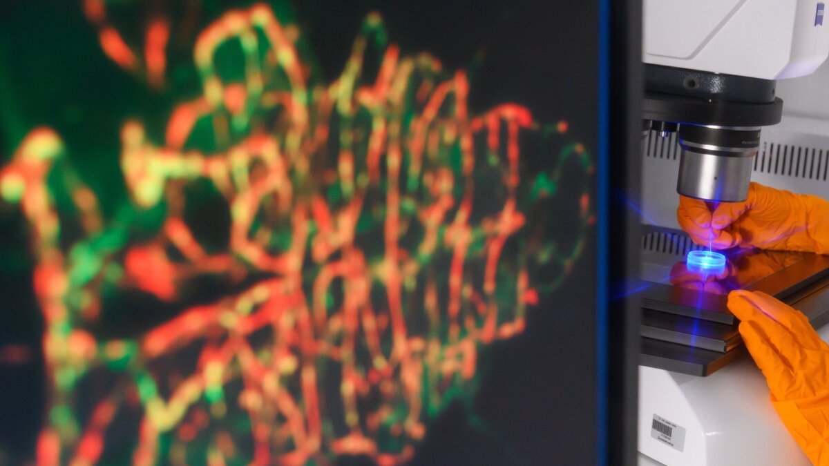 Fundamental and Applied Aspects of Fluorescence Microscopy with ...